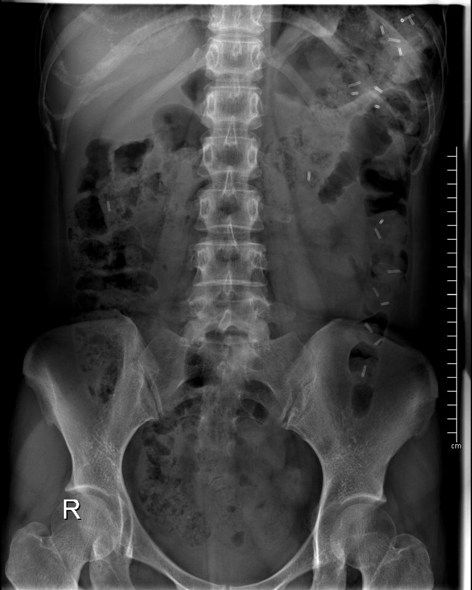 Service – CU-GI Motility